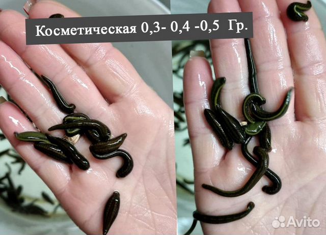 Пиявки медицинские